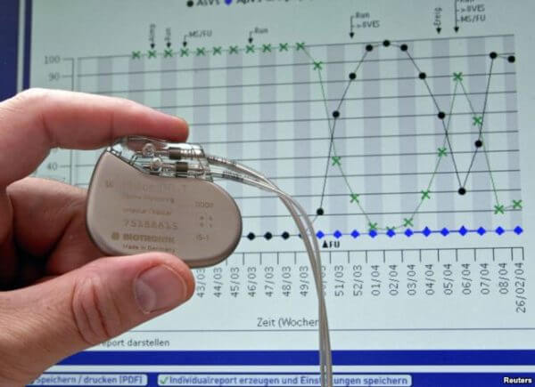 Tiny Pacemakers Change the Game - FloMedical